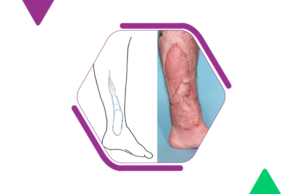 Advanced Upper and Lower Limb Reconstruction Surgery | #1 Best ...